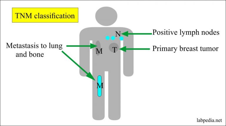 Tumor marker - Labpedia.net