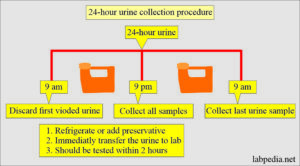 Urine 24-hours Collection, and Preservatives - Labpedia.net