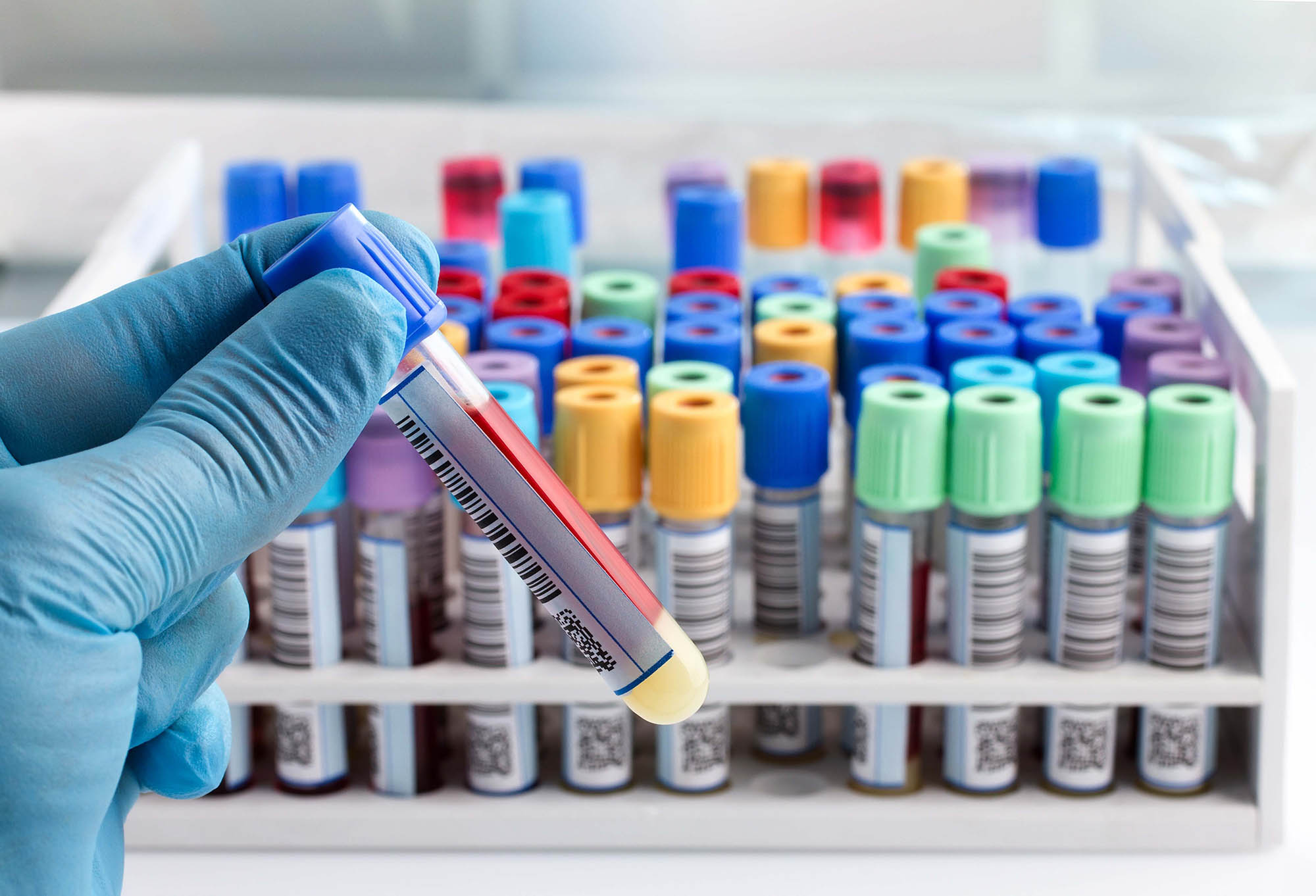 Laboratory Tests Indications And Significance Labpedia