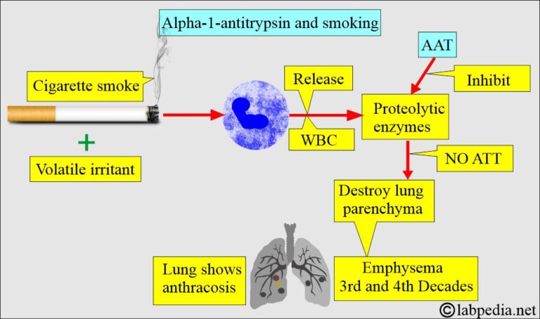 Understanding Alpha-1-Antitrypsin Deficiency and Its Impact