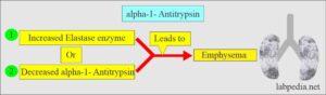alpha-1-antitrypsin Deficiency, (α1-antitrypsin or AAT Deficiency ...