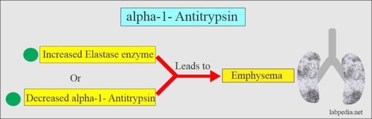 alpha-1-antitrypsin Deficiency, (α1-antitrypsin or AAT Deficiency ...