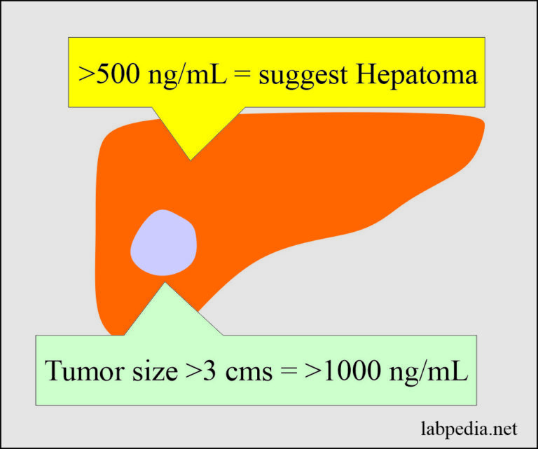 Tumor Markers:- Part 8 - Alpha-fetoprotein (AFP) - Labpedia.net