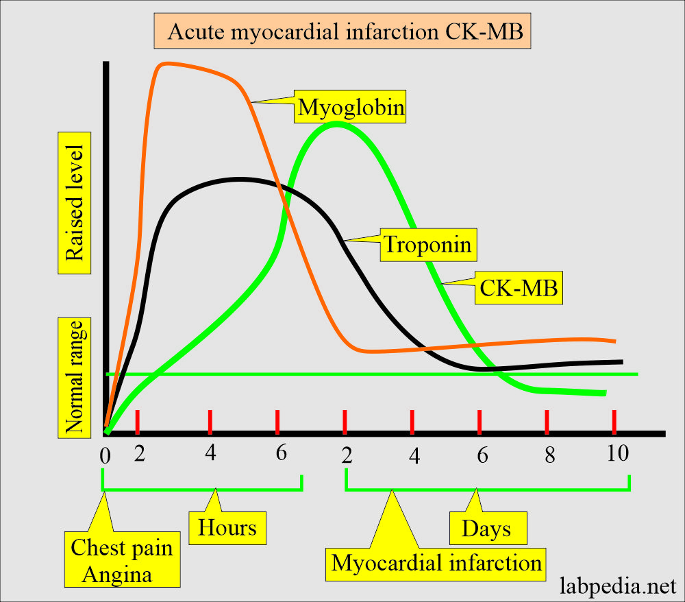 Cardiac Enzymes After Mi Hot Sex Picture