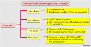 Cardiac marker:- Part 1 - Diagnosis of Acute Myocardial Infarction (AMI ...