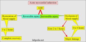 Cardiac marker:- Part 1 - Diagnosis of Acute Myocardial Infarction (AMI ...