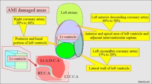 Cardiac marker:- Part 1 - Diagnosis of Acute Myocardial Infarction, AMI ...