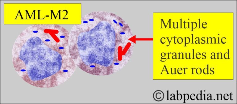 Understanding Acute Leukemias: Diagnosis and Types