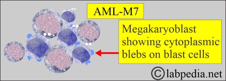 Understanding Acute Leukemias: Diagnosis and Types