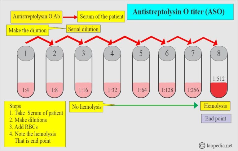 ASO Titer (Antistreptolysin O titer) - Labpedia.net