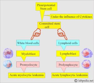 Understanding Acute Leukemias: Diagnosis and Types
