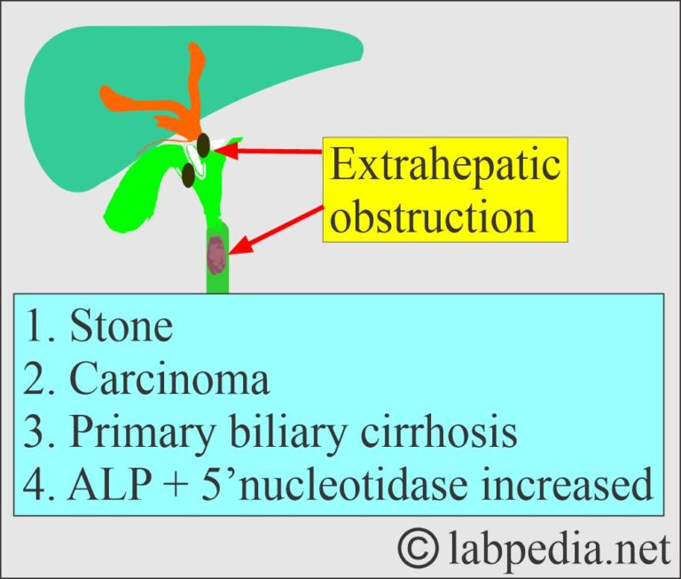Alkaline phosphatase (ALP) - Labpedia.net