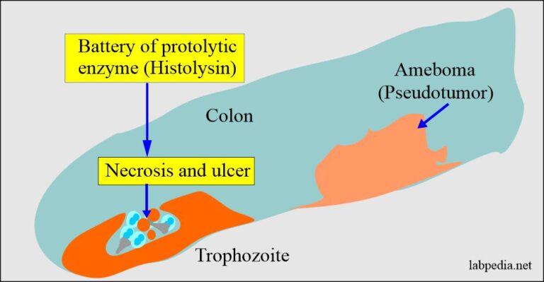 Amoebiasis, Entamoeba Histolytica, Life cycle, Diagnosis, and ...