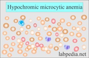 Red Blood Cell (RBC):- Part 5 - Summary of RBC Morphology ...