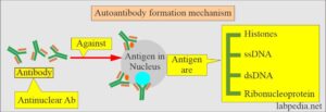 Anti-DNA, (anti-double-stranded DNA antibodies, Anti-ds-DNA Ab) and ...