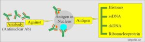Anti-DNA, (anti-double-stranded DNA antibodies, Anti-ds-DNA Ab) and ...