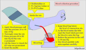 Blood banking:- part 3 - Blood Donation Procedure, Blood Components and ...