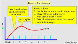 Blood Culture, its Procedure and Interpretations - Labpedia.net