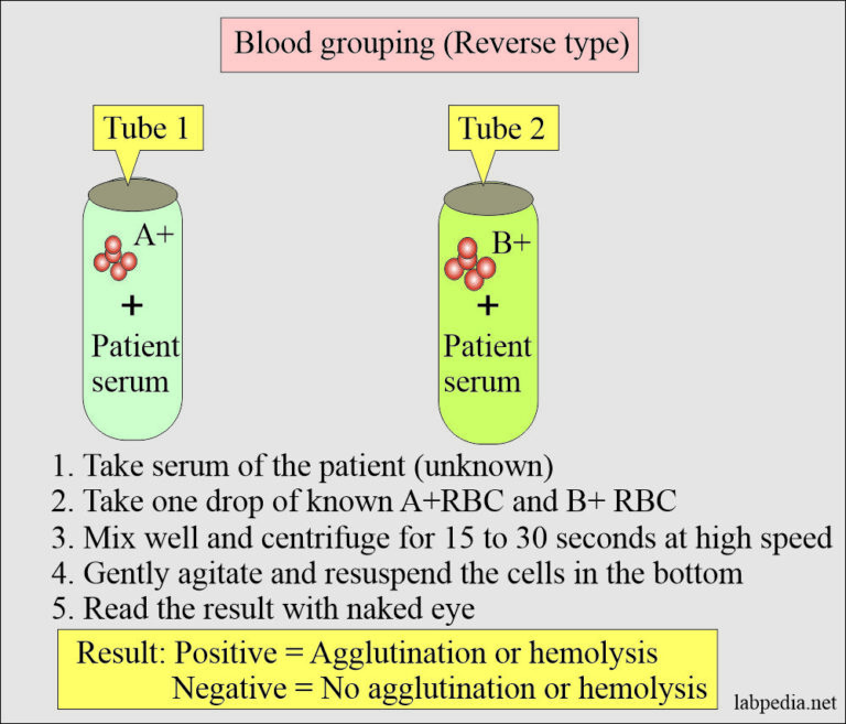 Blood banking:- part 1- Blood Groups ABO and Rh System, Blood Grouping ...