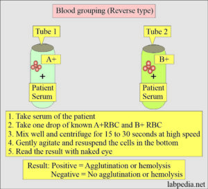 Blood banking:- part 1- Blood Groups ABO and Rh System, Blood Grouping ...