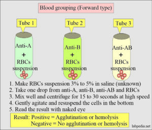 Blood banking:- part 1- Blood Groups ABO and Rh System, Blood Grouping ...