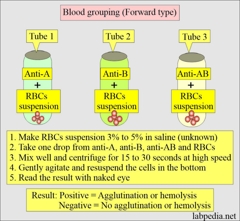 Blood banking:- part 1- Blood Groups ABO and Rh System, Blood Grouping ...