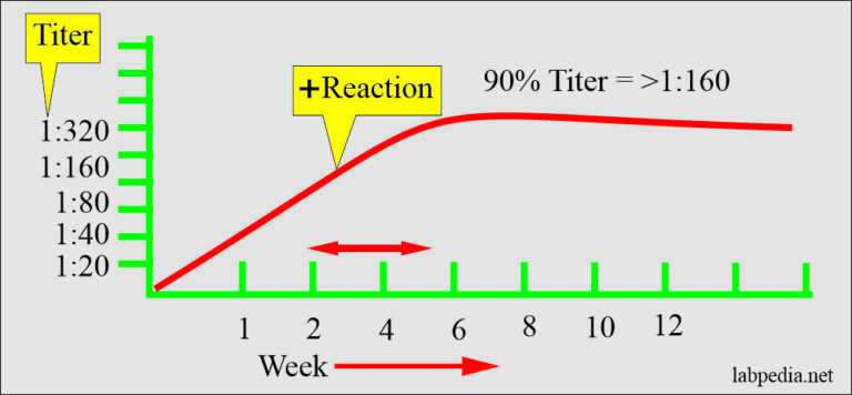 Brucellosis, Diagnosis of Brucella Infection - Labpedia.net