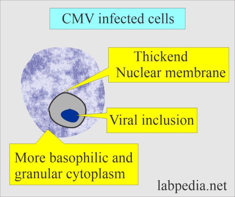 TORCH Profile:- Part 2 - Cytomegalovirus (CMV) - Labpedia.net