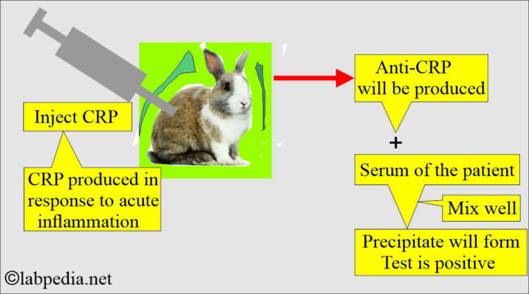 C-Reactive Protein (CRP), High-Sensitivity C-Reactive Protein (hs-CRP ...