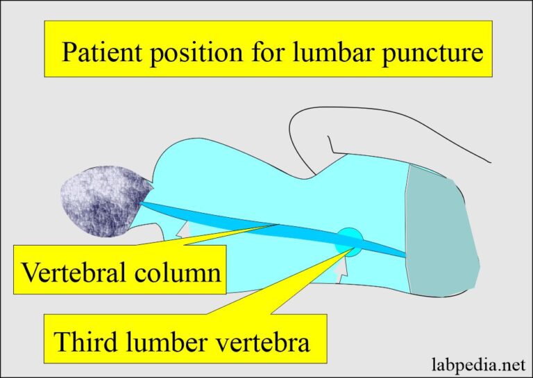 Cerebrospinal Fluid Analysis:- Part 2 - Cerebrospinal fluid (CSF ...