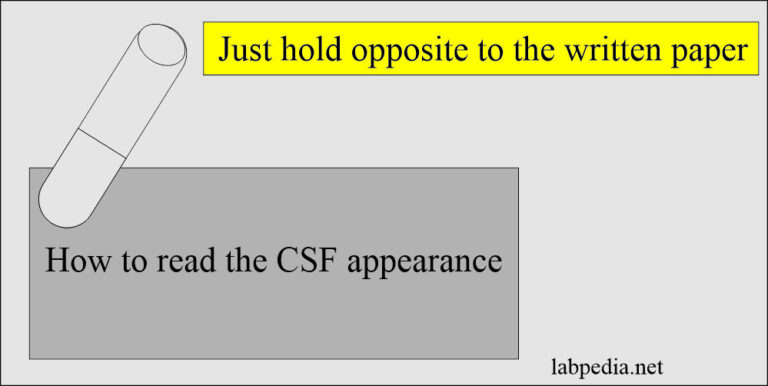 Cerebrospinal Fluid Analysis:- Part 2 - Cerebrospinal fluid (CSF ...
