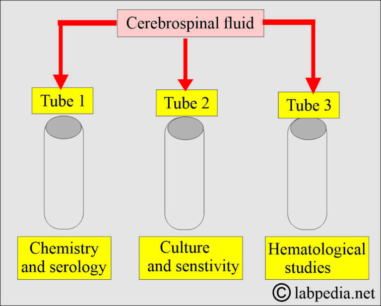Cerebrospinal Fluid Analysis:- Part 2 - Cerebrospinal fluid (CSF ...