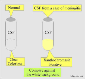 Cerebrospinal Fluid Analysis:- Part 2 - Cerebrospinal fluid (CSF ...