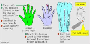 Types of Blood Samples, Criteria for rejection of the blood sample ...