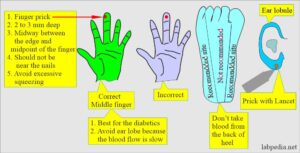 Types of Blood Samples, Criteria for rejection of the blood sample ...
