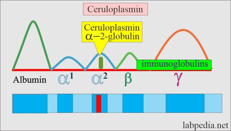 Ceruloplasmin, Copper Toxicity and Wilson's Disease - Labpedia.net