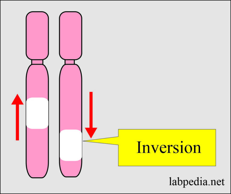 Chromosome studies, Blood Chromosome Analysis, Cytogenetics, Chromosome ...