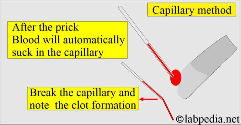 Coagulation: Clotting Time (C T) - Labpedia.net