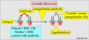 Hemolytic disease of newborn (HDN), and coombs test