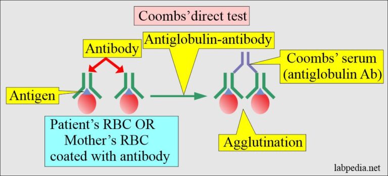 Coomb's test direct for the detection of antibody