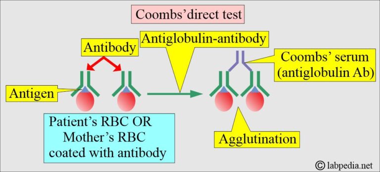 Coomb's test direct for the detection of antibody