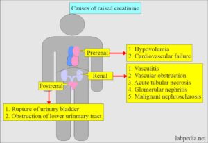 Creatinine (Serum Creatinine) - Labpedia.net