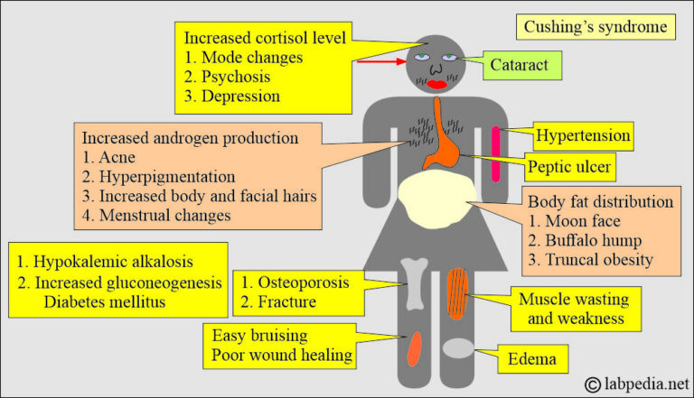 Cortisol Hormone, Hydrocortisone (AM and PM) and Cushing's syndrome ...