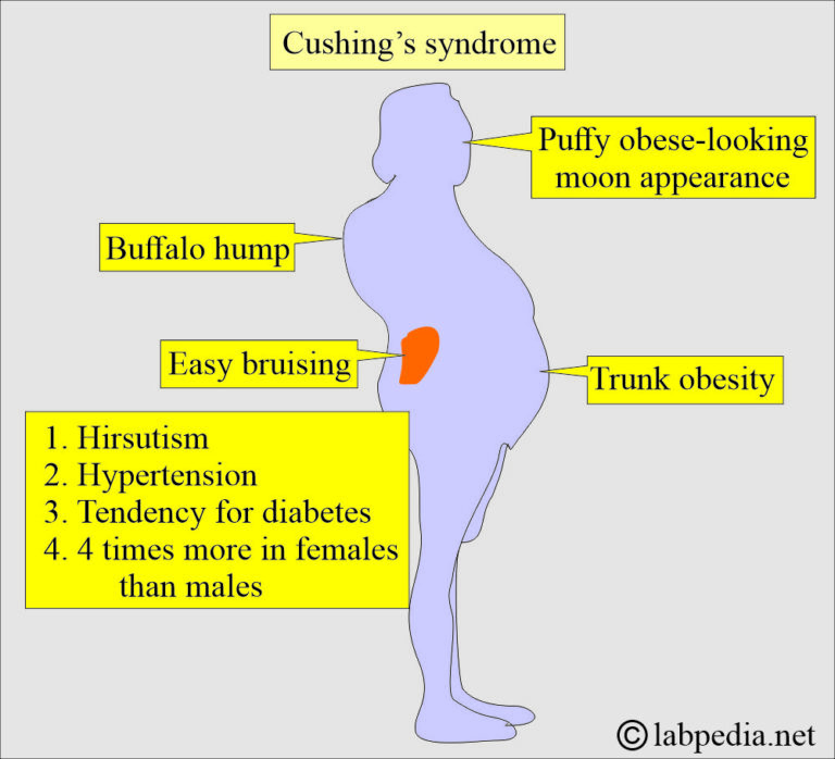 ACTH (Adrenocorticotropic Hormone), Cushing's Syndrome - Labpedia.net
