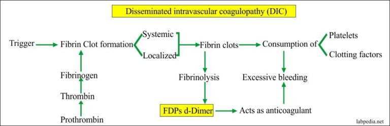 D-Dimer test, Fragment D-dimer, Diagnosis of Disseminated Intravascular ...