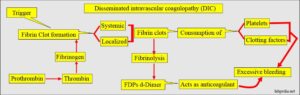 Disseminated Intravascular Coagulopathy (DIC), Diagnosis...