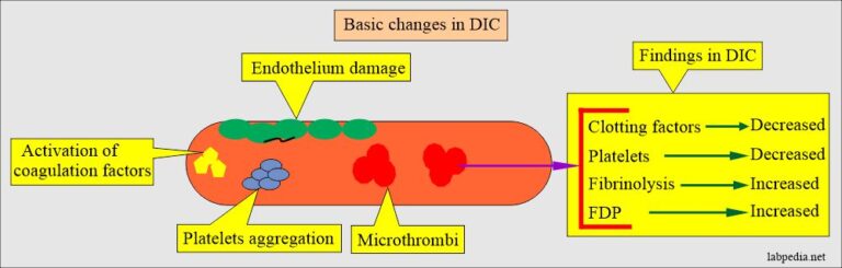 Disseminated Intravascular Coagulopathy (DIC), Diagnosis...