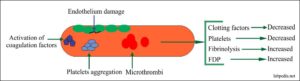 D-Dimer test, Fragment D-dimer, Diagnosis of Disseminated Intravascular ...