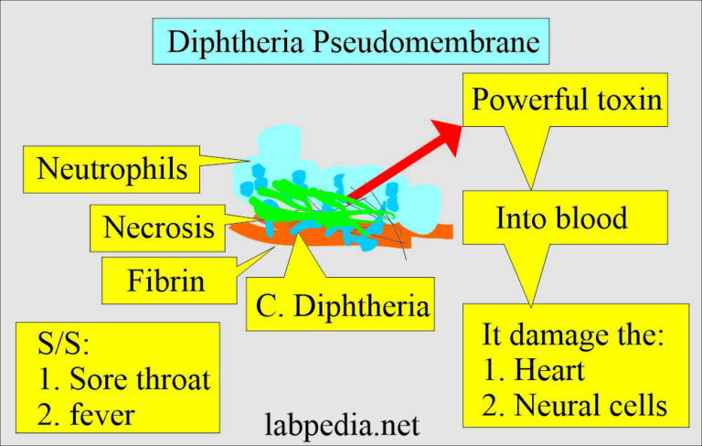 Klebs Loeffler bacilli (KLB), Corynebacterium Diphtheriae, Diagnosis ...