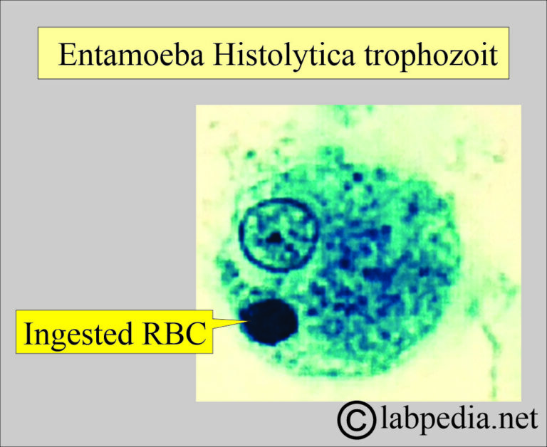 Entamoeba Histolytica, Life cycle, Amebiasis Diagnosis - Labpedia.net